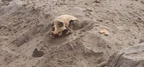 SunLive - Human skull find at hospital - The Bay's News First