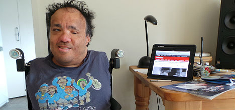 SunLive - Thalidomide victim ‘it’s not over yet’ - The Bay's News First